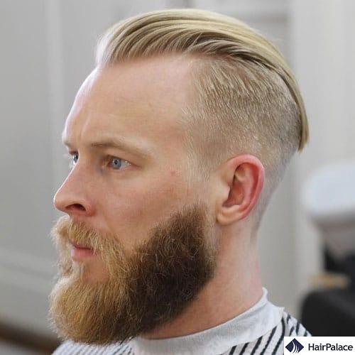 Receding hairline: symptoms, stages, causes, and treatment options