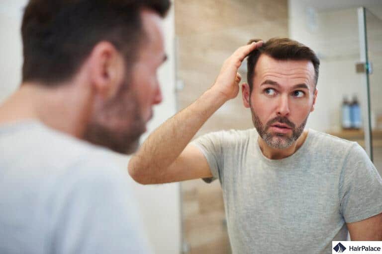 Mature Hairline: Everything You Need to Know