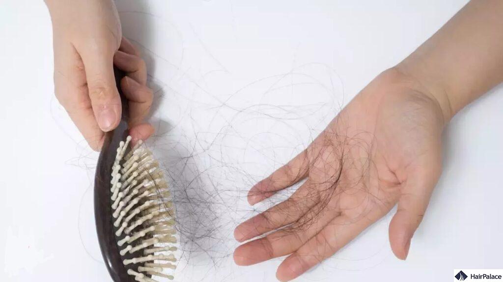 Why Is My Hair Falling Out 15 Reasons And Treatments