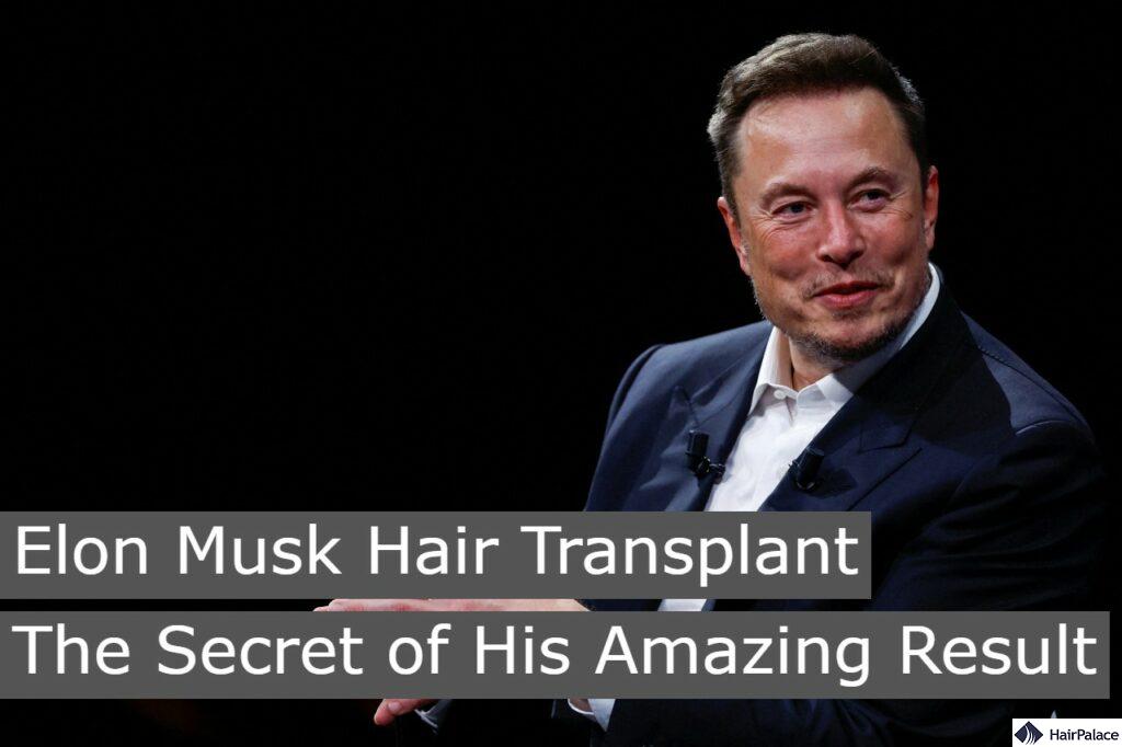 Elon Musk Hair Transplant: The Secret of His Amazing Result