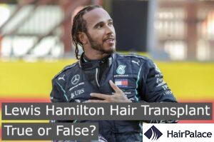 Lewis Hamilton Hair Transplant: True or False?
