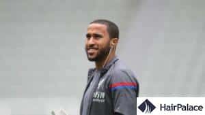 Andros Townsend Hair Transplant: Behind the Spectacular Result