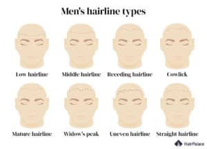 Hairline Types for Men and Women & How to Change Yours