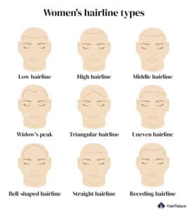 Hairline Types for Men and Women & How to Change Yours