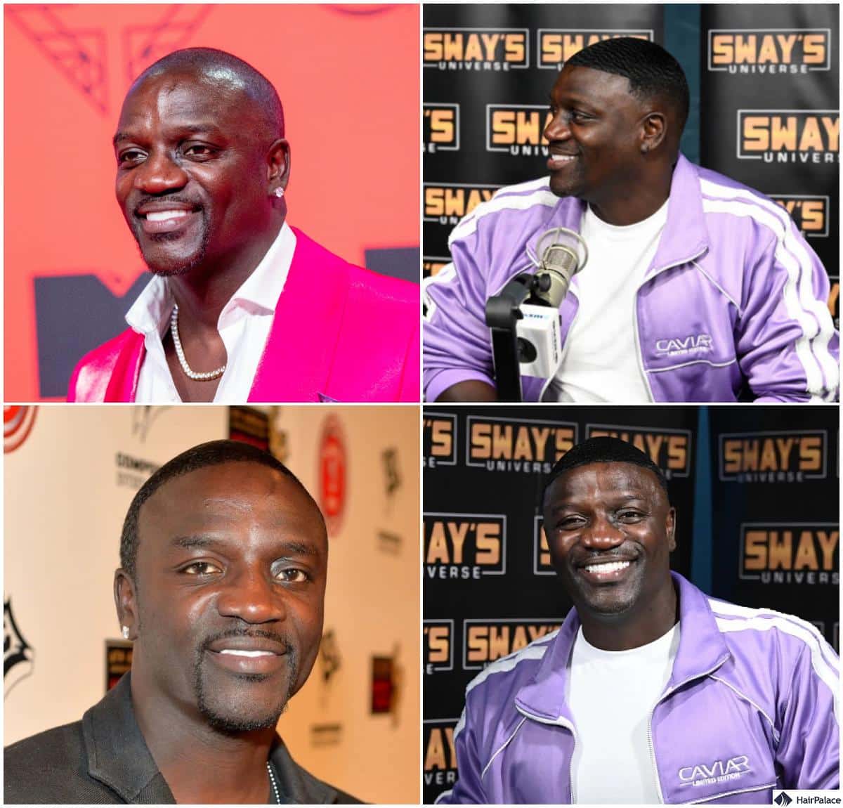 Akon Hair Transplant: What Went Wrong?