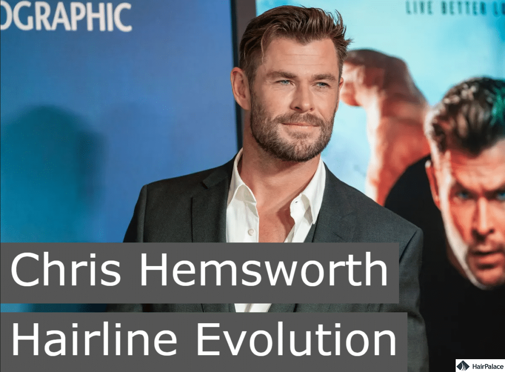 Chris Hemsworth Hairline Evolution