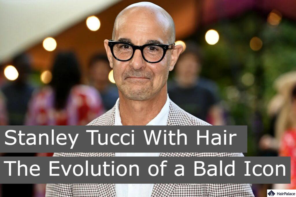 Stanley Tucci With Hair: The Evolution of a Bald Icon