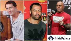 Joe Rogan Hair Transplant | Why Did it go Wrong?