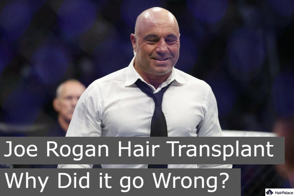 Joe Rogan Hair Transplant | Why Did it go Wrong?