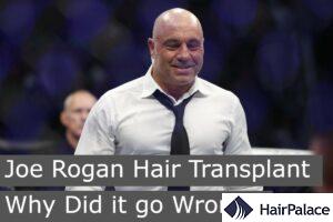 Joe Rogan Hair Transplant | Why Did it go Wrong?