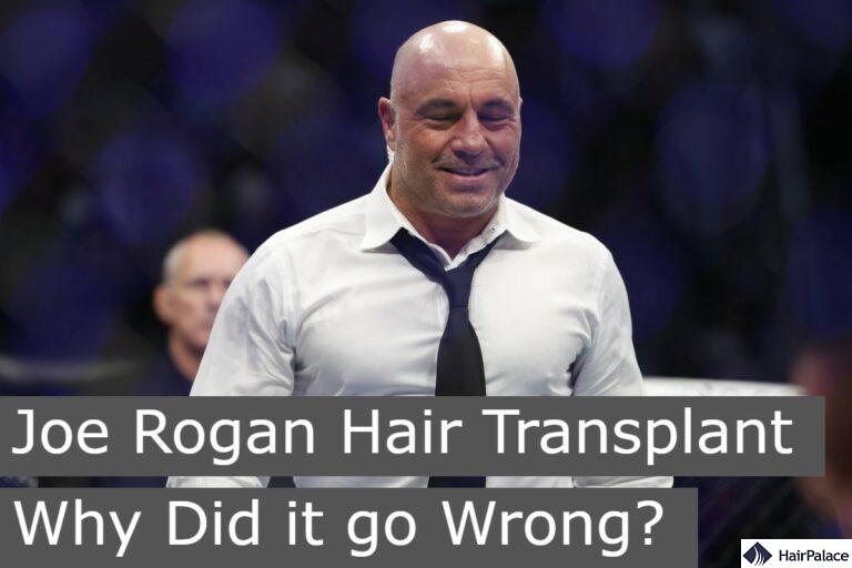 Joe Rogan Hair Transplant | Why Did it go Wrong?