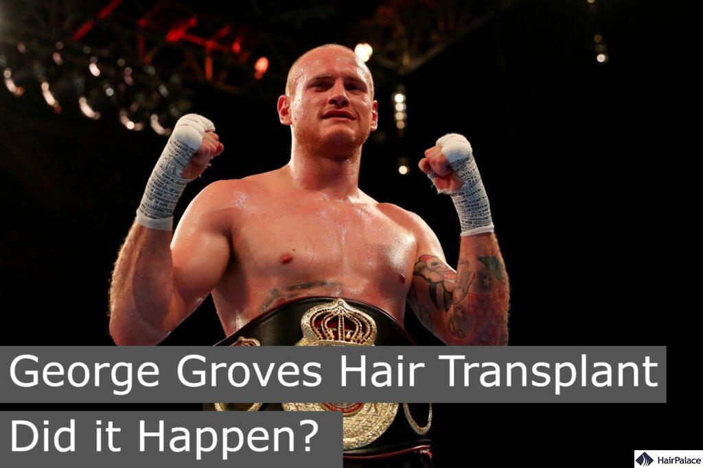 George Groves Hair Transplant | Did it Happen?