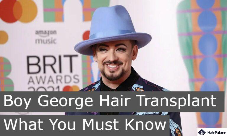 Boy George Hair Transplant: What You Must Know