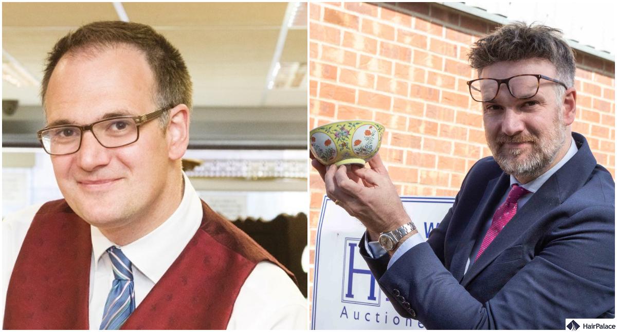 Charles Hanson Hair Transplant: Stunning Transformation!