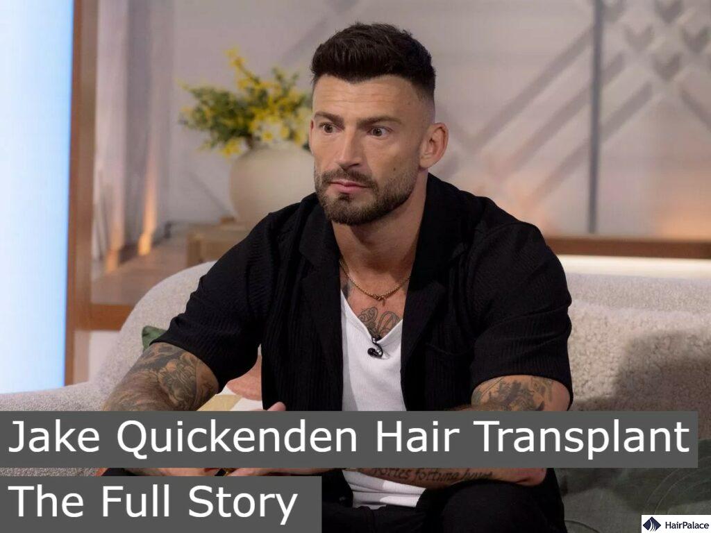 The Full Jake Quickenden Hair Transplant Story