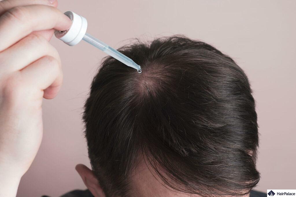 Minoxidil 10 Percent: Is This The Best Dosage?